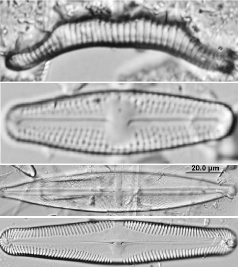Sorting Out the Taxonomy of North American Diatoms | NSF NEON | Open ...